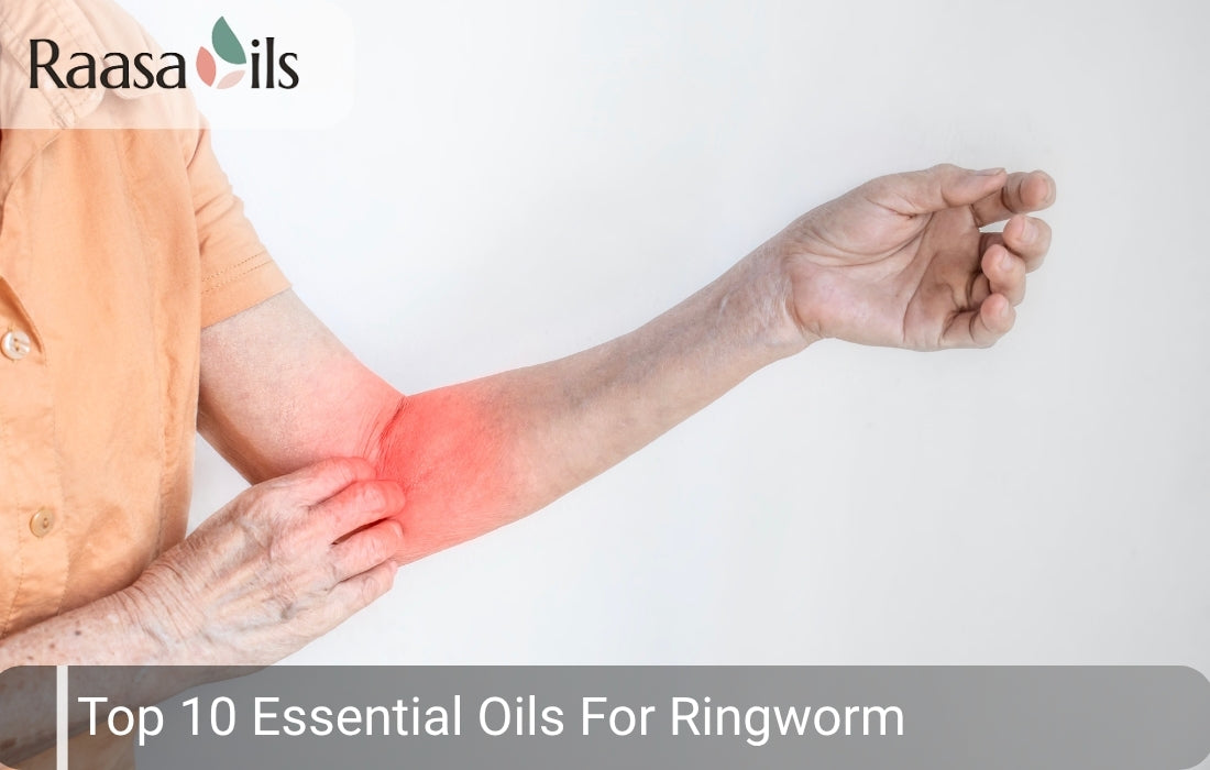 Essential Oils To Help With Ringworm: DIY Recipe & How to Use – Raasa ...